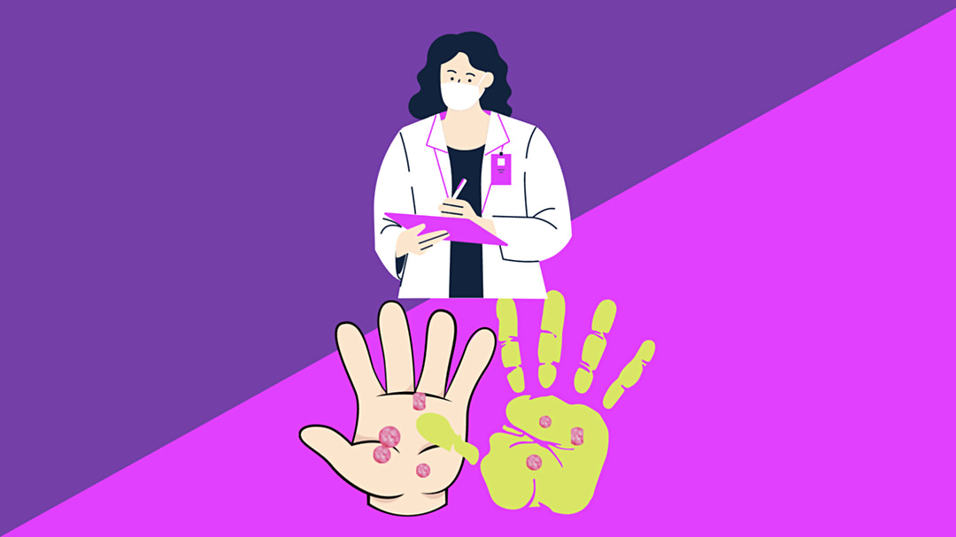 Janeway Lesions - Osler Nodes - FAQ - World Health Support