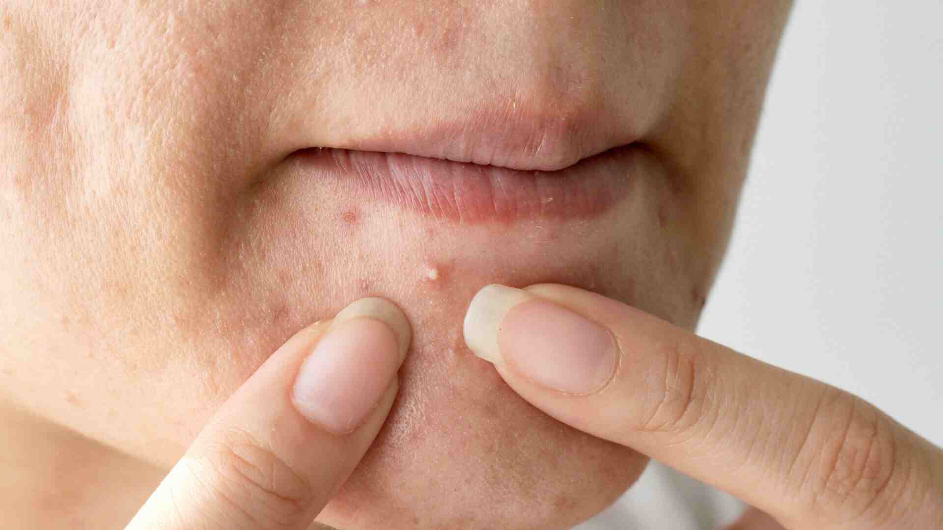 Common Skin Disorders and How to Treat Them - International Health 24